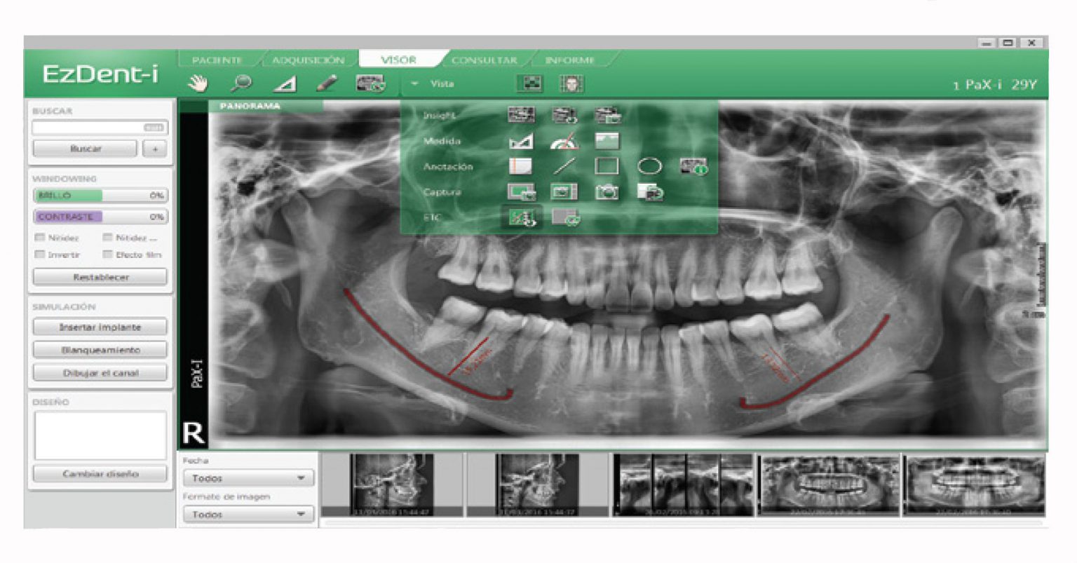 SOFTWARE EzDent-i DE VATECH - Rogersan